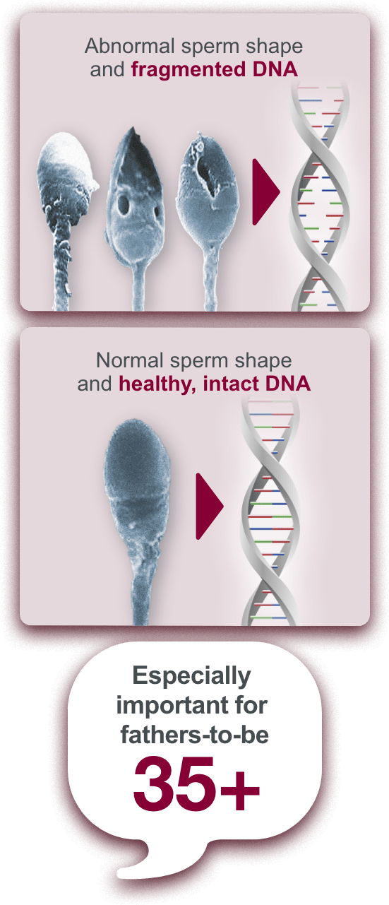 DNA breaks can affect sperm shape › PROFERTIL